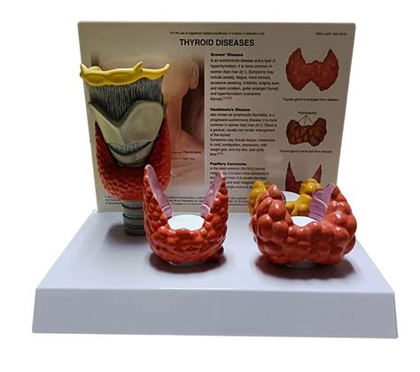 Kh66zky Thyroid Anatomy Model Thyroid Nodule Model For Science