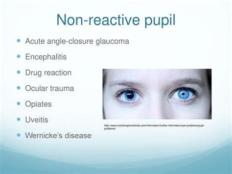Wessex Lmc Masterclass Ppt Download