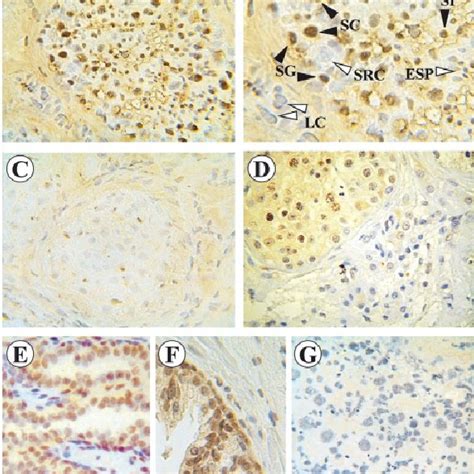 Pdf Localization Of Estrogen Receptors α And β In Human Testis
