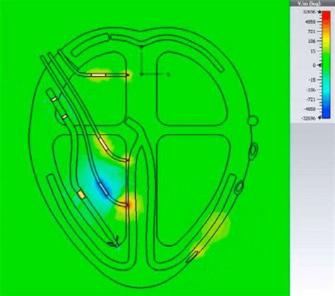 Electrical Bipolar Pacing Field Of Active Cardiac Contractility
