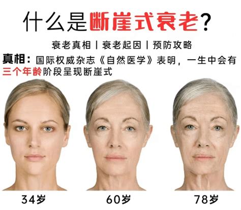 什么是“断崖式衰老” 伊的家
