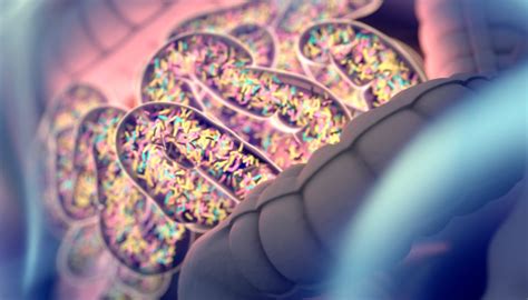 C Difficile Recurrence Who Is Most At Risk Mayo Clinic Press