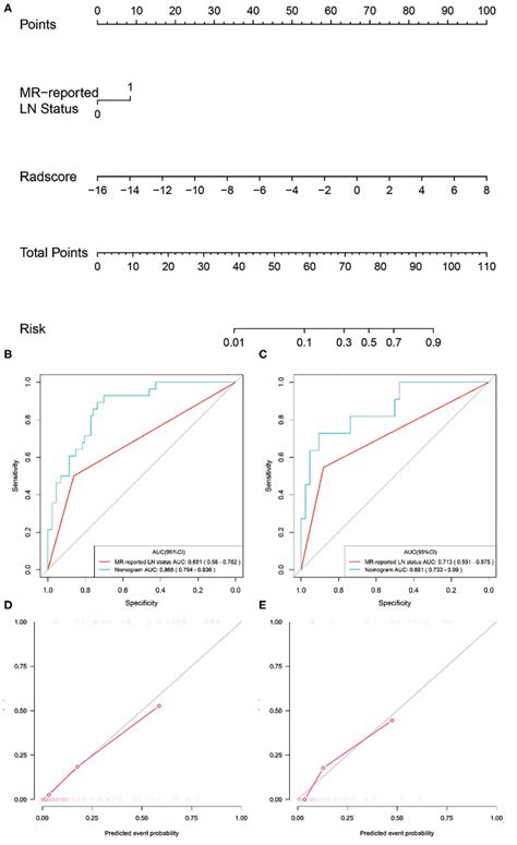Radiomics Analysis Of Multiparametric Mri For The Preoperative