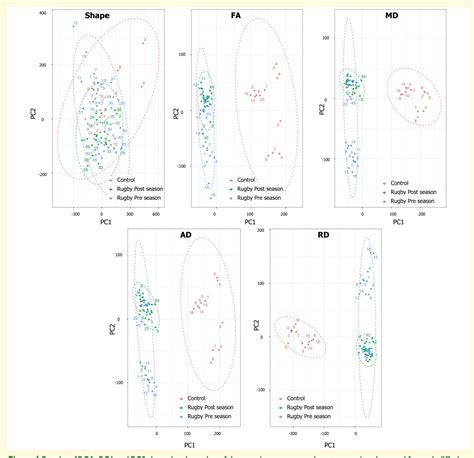 Figure 1 From Integration Of Diffusion Tensor Imaging Parameters With Mesh Morphing For In Depth