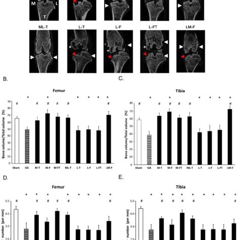 Micro Ct Analysis A Micro Ct Images Illustrated The Positions Of