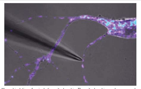 Figure 1 From Dna Sequencing Basics And Its Applications Semantic Scholar
