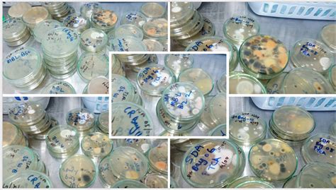 Microbial Load Test Bioburden Test