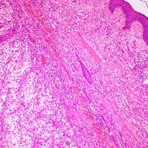 Scalp Mass With 3 Years Duration Download Scientific Diagram