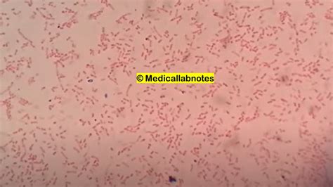 Bipolar Staining Introduction Uses And Keynotes