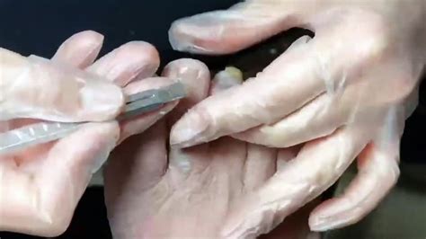 Moldy Nails Pedicure Instruction View The Cuticles Treatment For