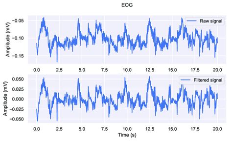 Raw Electrooculography Eog Sensor Signal And Filtered Signal