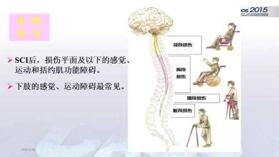 脊柱脊髓损伤的症状图片 脊柱脊髓损伤图片大全 脊柱脊髓损伤 39疾病百科