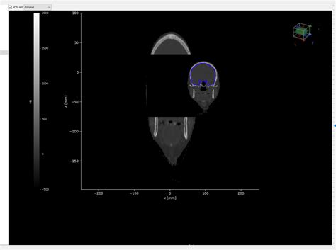 Bug Canvas Breaks When Contours Are Shown · Issue 555 · Pytrippytripgui · Github
