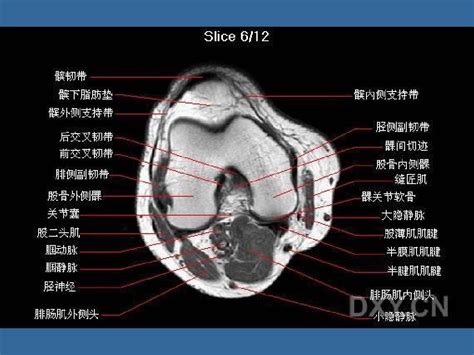 正常膝关节mri解剖图 千图网