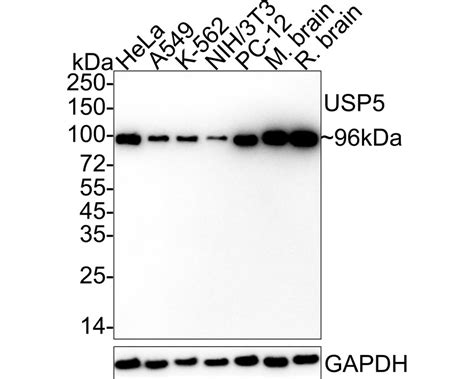 Usp5 Recombinant Rabbit Monoclonal Antibody Je77 42 Ha722371 Huabio