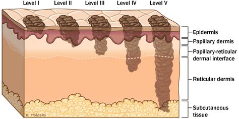 Skin Cancer ‣ Anatomy ‣ Thanc Guide