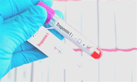 High Sensitivity Cardiac Troponin Test May Overestimate Risk In
