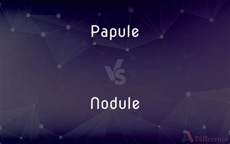 Papule Vs Nodule — Whats The Difference