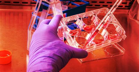 Monkeypox Is Spreading Through Sex WHO Disease Specialist Says