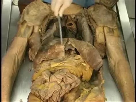 Lab Quiz 9 10 Upper Appendicular Muscles Flashcards Quizlet Lab Quiz 9 10 Upper Appendicular Muscles Flashcards Quizlet