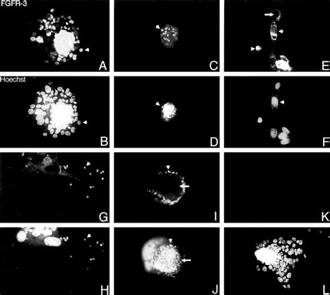 Fgfr 3 Protein Is Detected In Icm Extraembryonic Ectoderm And Download Scientific Diagram