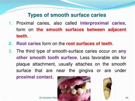 Ppt Preventive Dentistry I And Ii Powerpoint Presentation Free