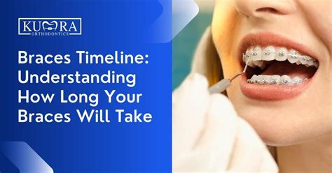 Braces Timeline Understanding How Long Youll Braces Will Take Kumra Orthodontics