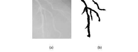 Segmentation Using Rsf Model A Original Image B Segmentation