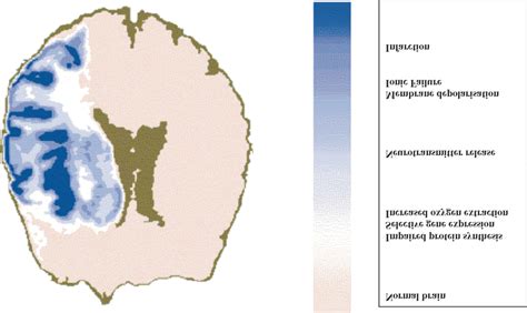 The Ischemic Penumbra The Illustration Shows The Heterogeneity Of The Download Scientific