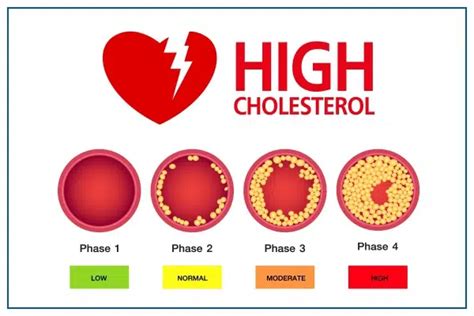 Dealing With High Cholesterol