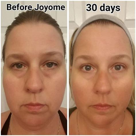 Pin By Melissa Davenport On Plexus Skin Science Healthy Skin Care Plexus Products