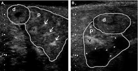 Quantitative Contrast‐enhanced Ultrasonographic Assessment Of Naturally