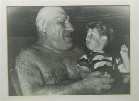 Acromegaly Natural Height Growth