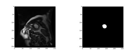 Github Kevkibe Image Segmentation Using Tensorflow Perform Semantic Segmentation To Classify