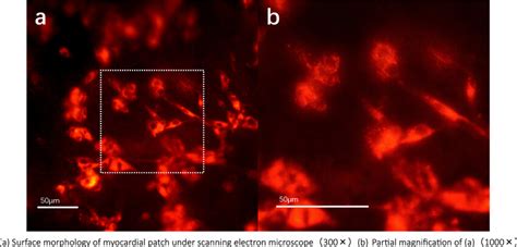 Sem Of A Cm Patch Surface Morphology Of A Myocardial Patch Under Sem Download Scientific