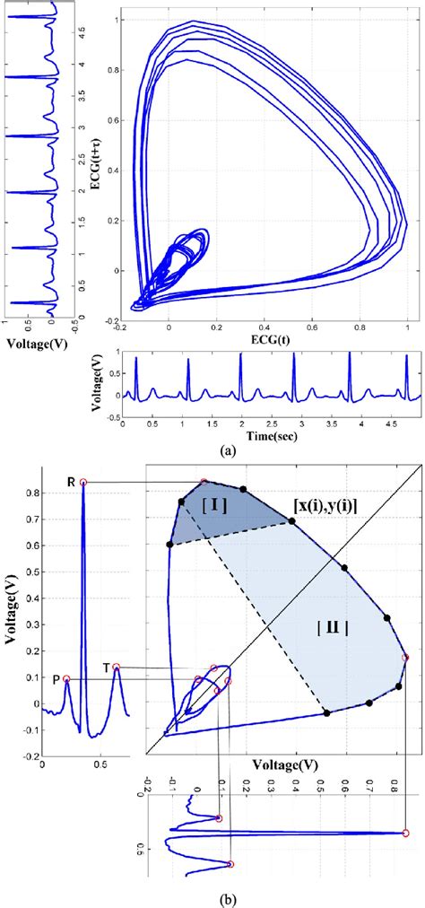 Figure 1 From A Real Time Qrs Detection Method Based On Phase Portraits