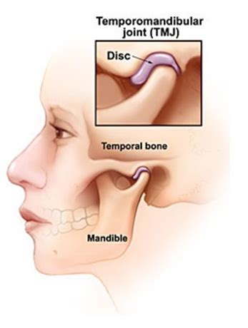 Temporomandibular Joint Diagram