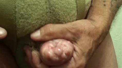 Nullo Playing With Amputated Penis