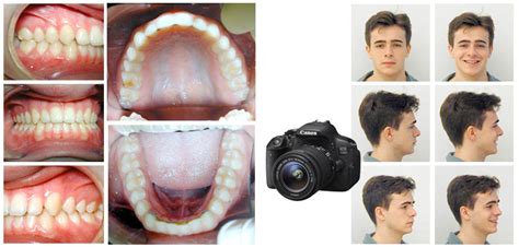 Un Buen Estudio De Ortodoncia Clínica Dental Cerrolaza