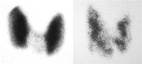 Aging Figure 1 Endotext