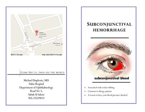 Subconjunctival Hemorrhage Diagram Subconjunctival Hemorrhage Broken