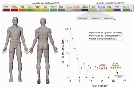 Method Spatial Acuity Was Assessed By Measuring 2 Point Discrimination