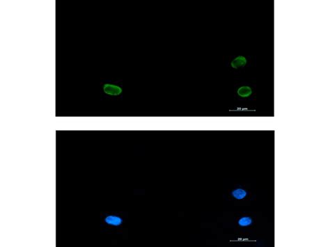 兔抗snap29单克隆抗体anti Snap29 Rabbit Monoclonal Antibody 生命科学产品与技术服务 生工生物工程