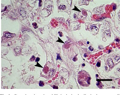 Sheep Pox Virus Induces Proliferation Of Type Ii Pneumocytes In The
