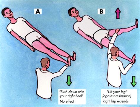 Functional Symptoms And Signs In Neurology Assessment And Diagnosis