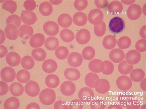Fuente Atlas Hematologia Serie Roja Ontogenia