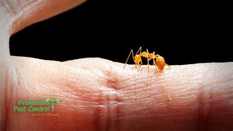 The Best Ways To Treat Ant Bites Prohealth Pest Control