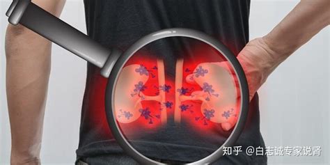 男性朋友睡觉出汗是怎么回事？这几种情况不可忽视！ 知乎