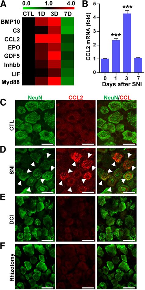 Ccl2 Mediates Neuron Macrophage Interactions To Drive Proregenerative Macrophage Activation