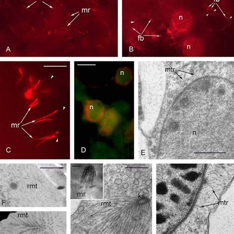 Organisation Of Microtubular Cytoskeleton In P Belevskii A D